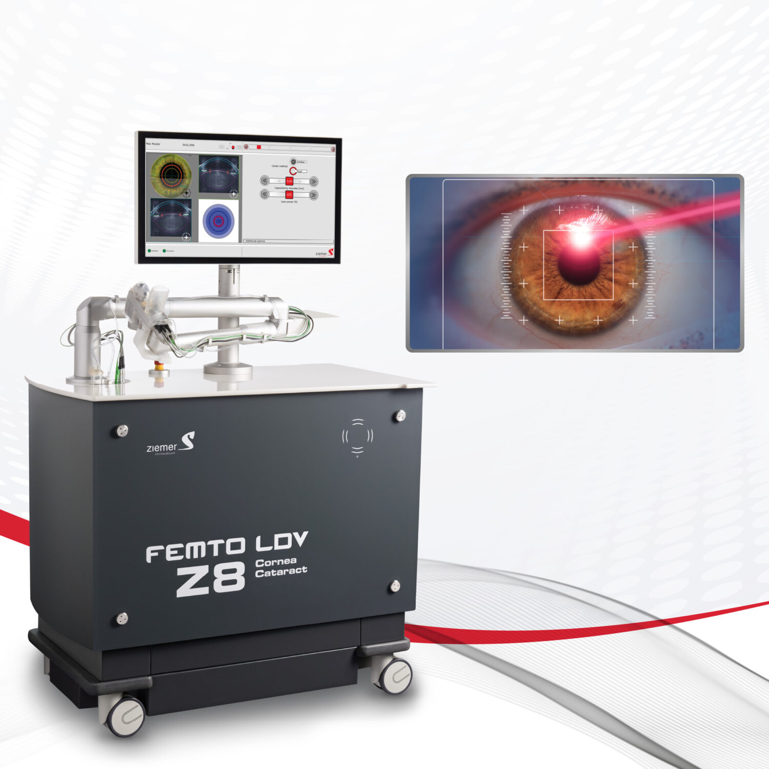 Phaco laser giá bao nhiêu? So sánh chi phí với phương pháp truyền thống